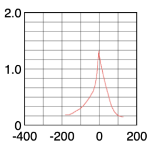 Tympanometry Explained | How to interpret results | ODYO