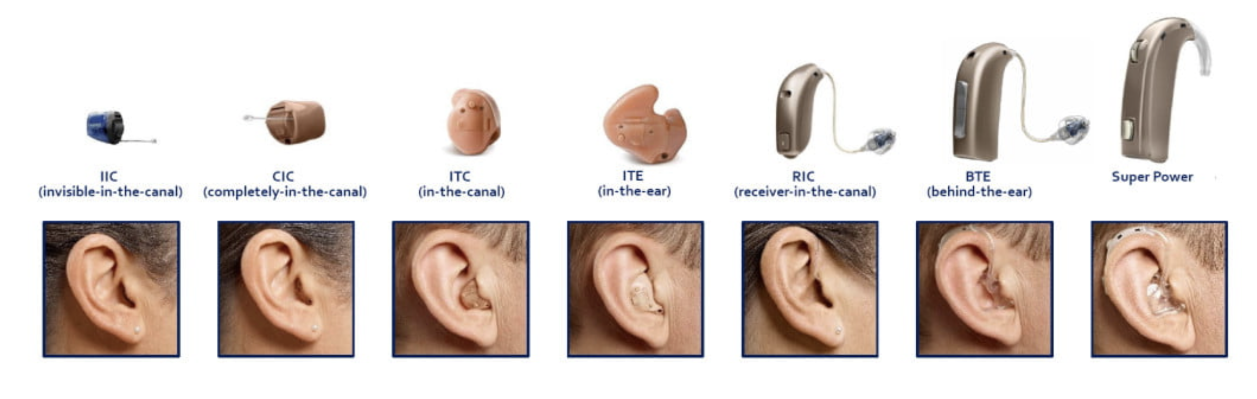 Appareils auditifs : Un guide simple pour les patients expliqué par un ...