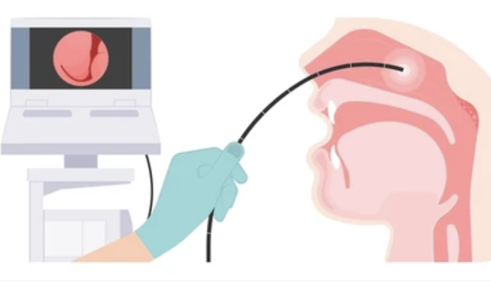 Patulous Eustachian tube: Symptoms, Diagnosis, and Treatment Explained